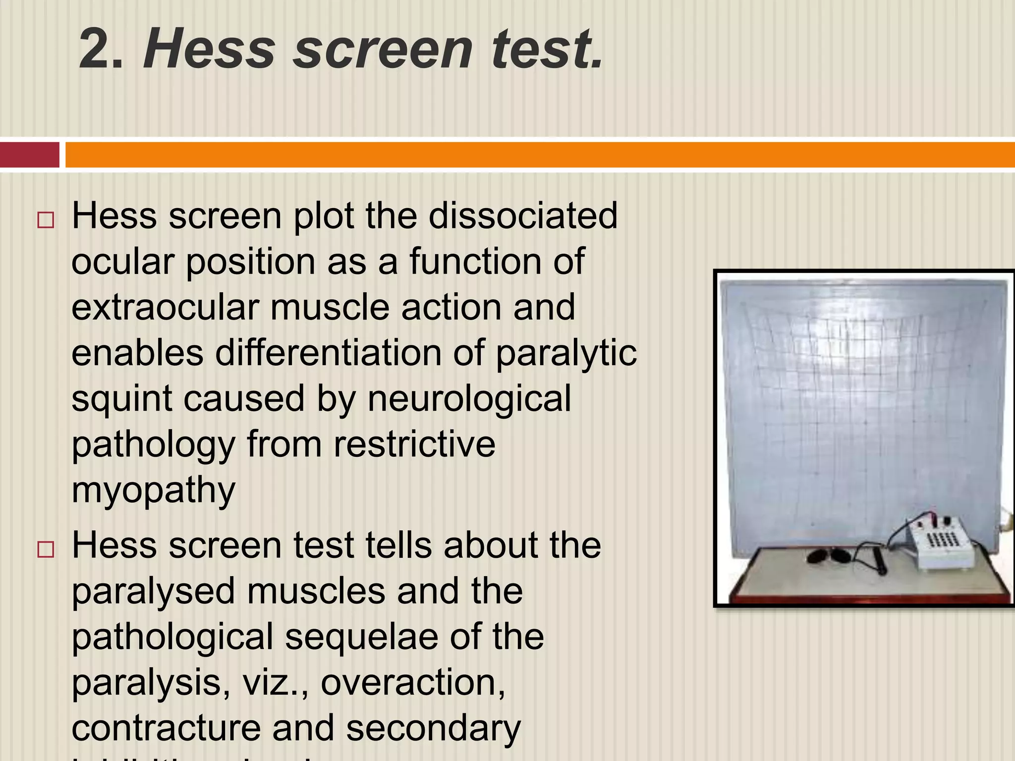 Evaluation of squint | PPTX