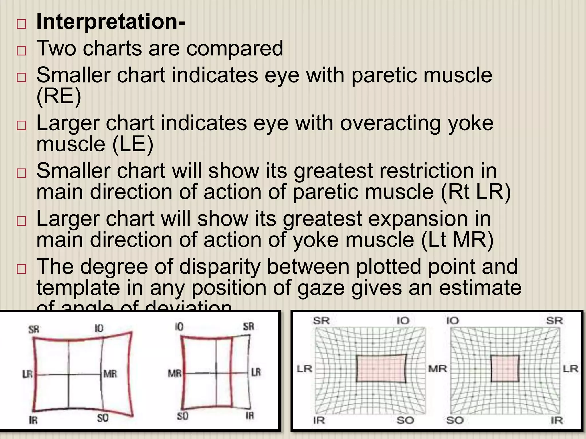 Evaluation of squint | PPTX