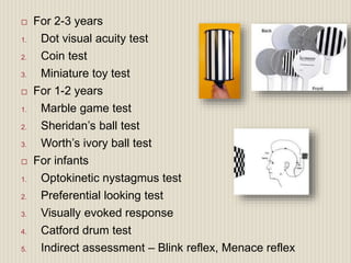 Evaluation of squint | PPTX