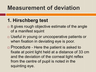 Evaluation of squint | PPTX