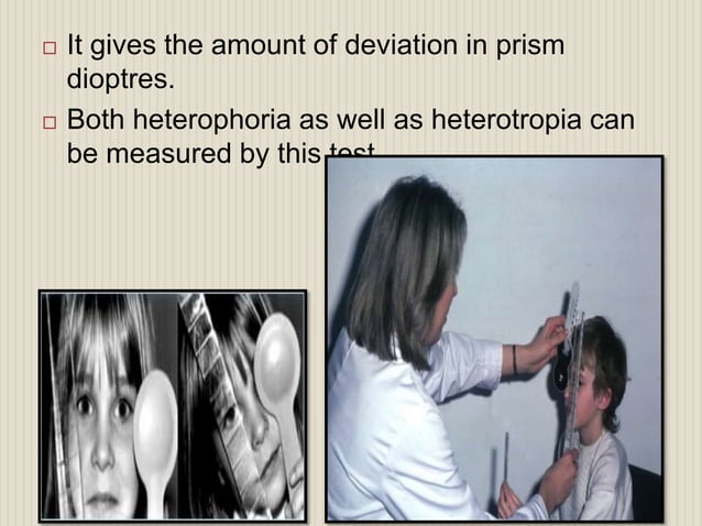 Evaluation of squint | PPTX