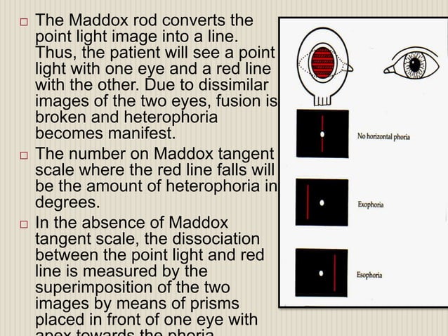 Evaluation of squint | PPTX