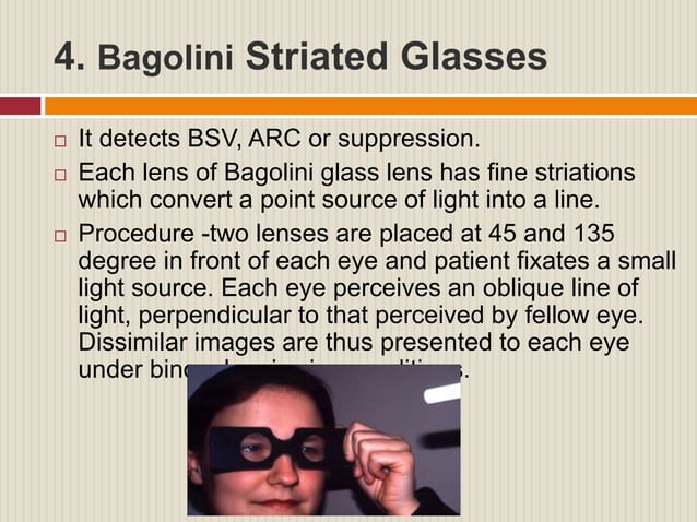 Evaluation of squint | PPTX