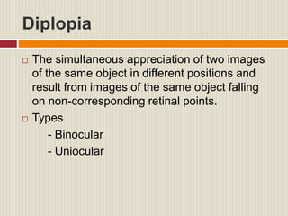 Evaluation of squint | PPTX