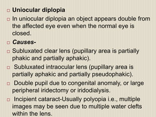 Evaluation of squint | PPTX