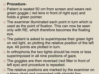 Evaluation of squint | PPTX