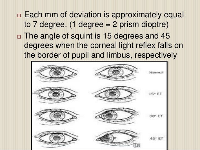Evaluation of squint