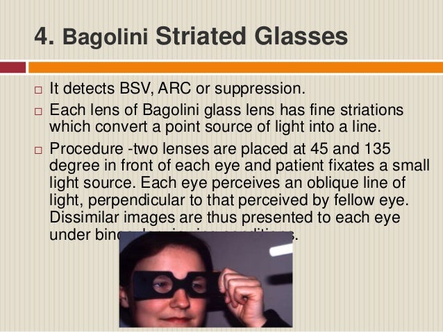 Evaluation of squint