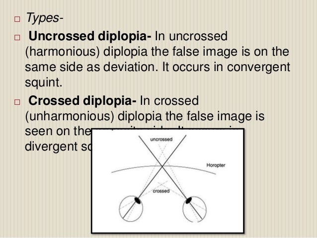 Evaluation of squint