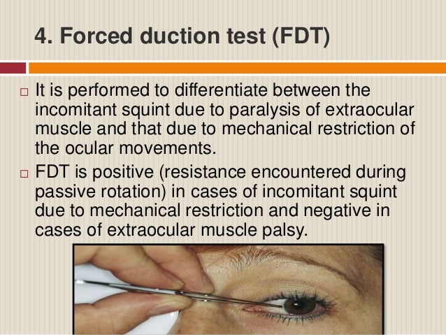 Evaluation of squint