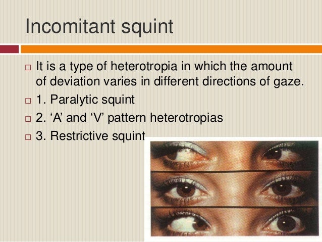 Evaluation of squint