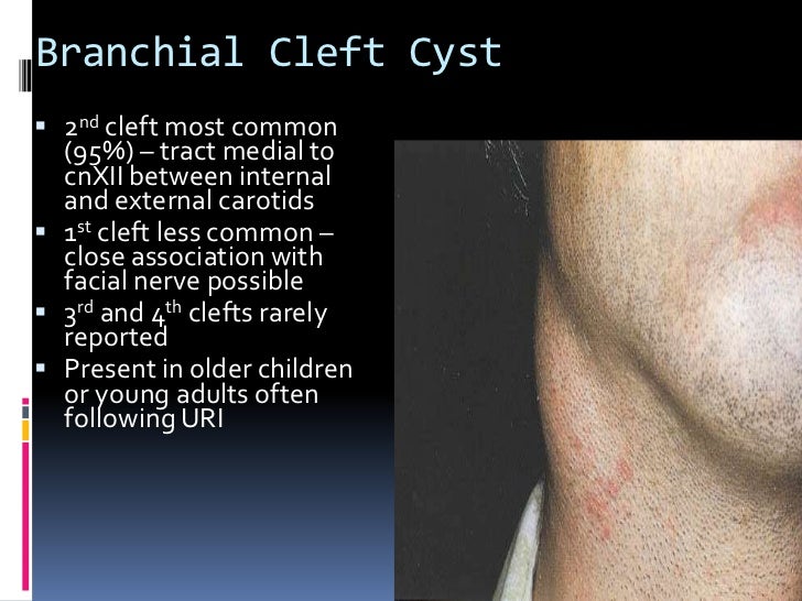 Evaluation of neck tumors