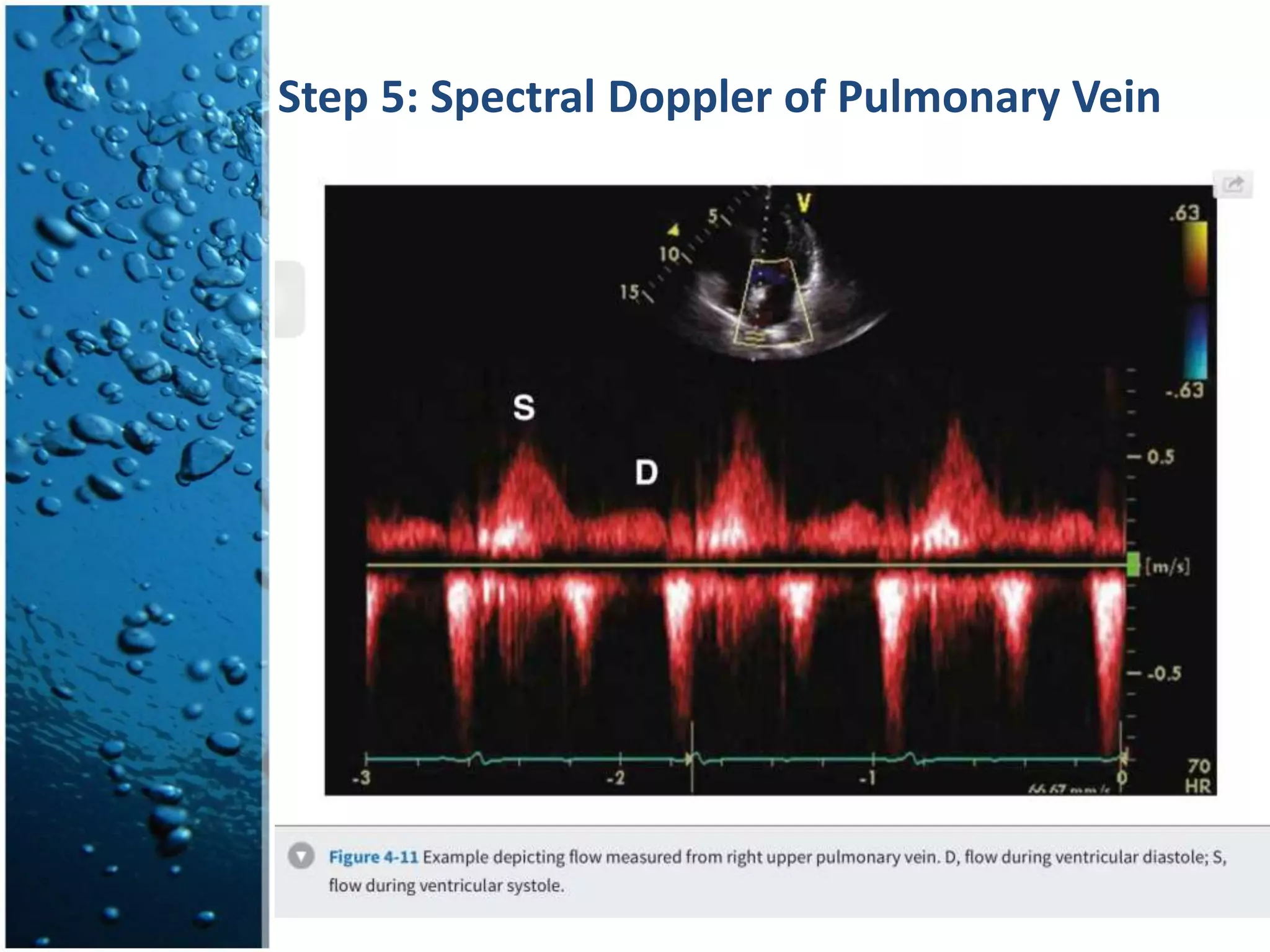 Evaluation of the patent with diastolic dysfunction bv tam duc | PPT