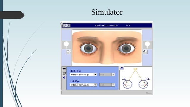 Evaluation of squint - The Basics | PPT | Eye and Vision Conditions ...