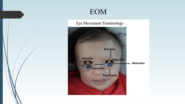 Evaluation of squint - The Basics | PPT | Eye and Vision Conditions ...
