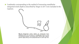 EVALUATTION OF ANTEGONIAL NOTCH DEPTH FOR GROWTH PREDICTION.pptx