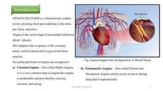 Evalution of Anti-Anginal Drugs, Animal models for Angina, Both IN VIVO ...