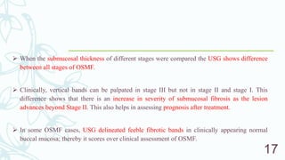 Evalution of oral submucous using usg | PPTX