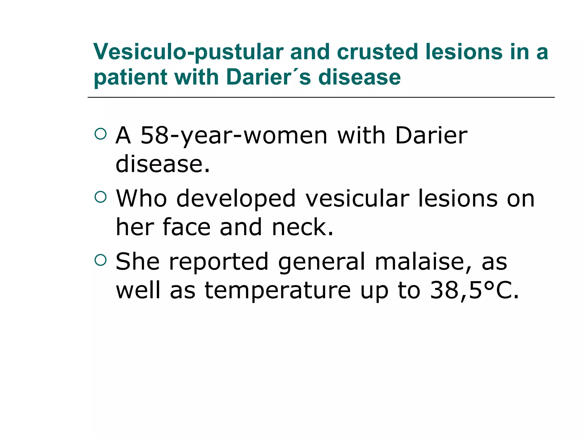 Vesiculo-pustular and crusted lesions in a patient with Darier´s ...