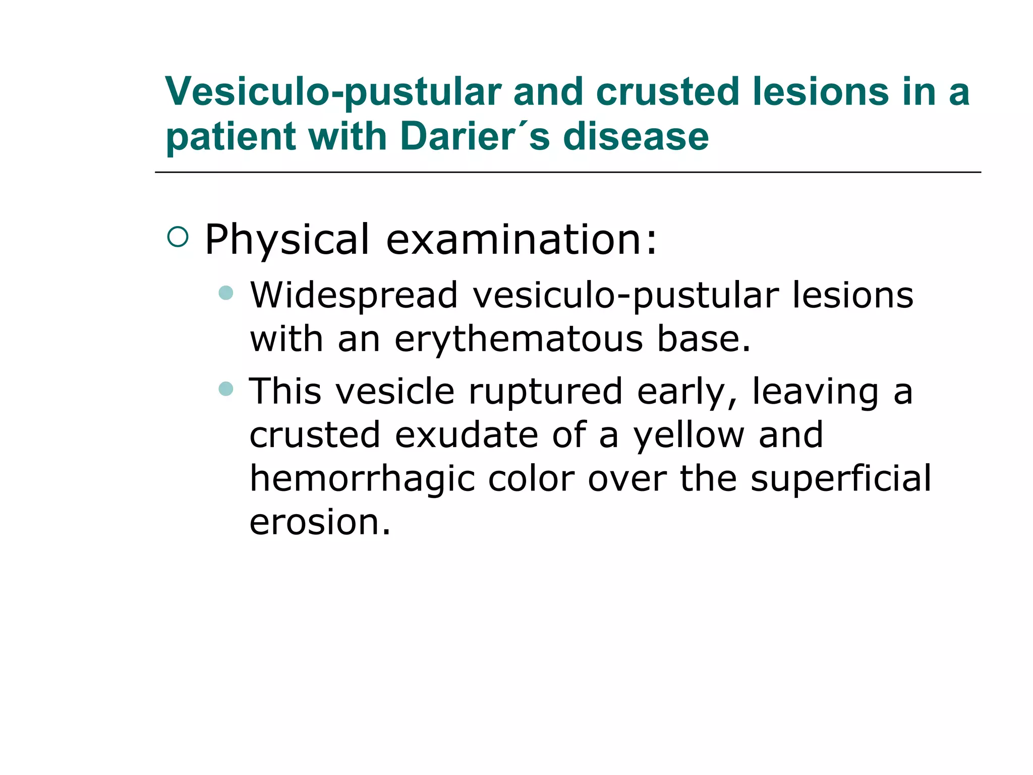 Vesiculo-pustular and crusted lesions in a patient with Darier´s ...
