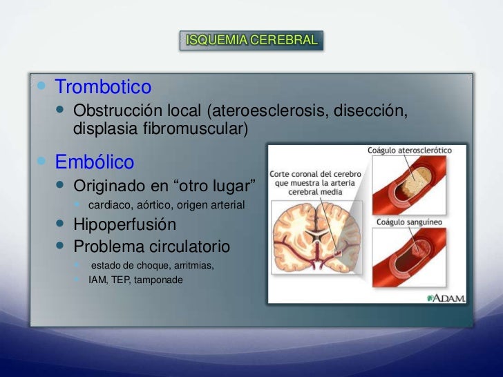 Evento Vascular Cerebral (EVC)