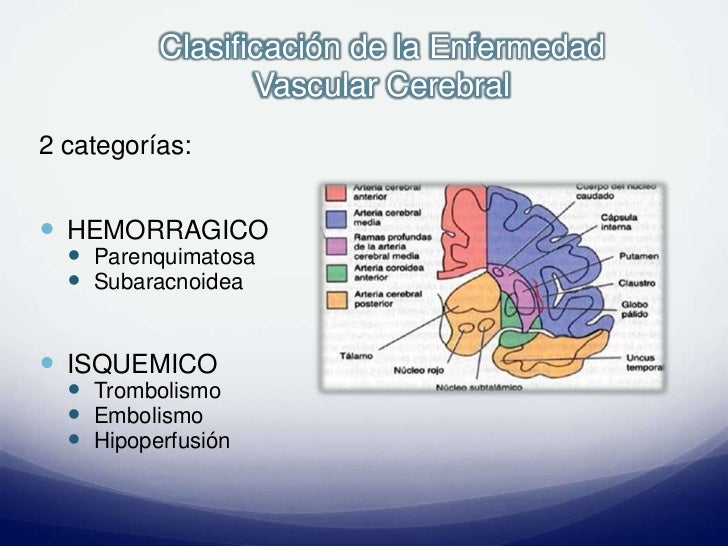 Evento Vascular Cerebral (EVC)
