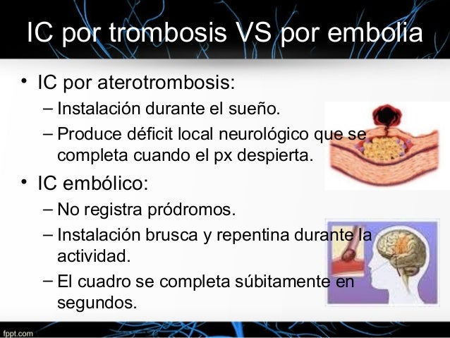 EVC isquémico y hemorrágico