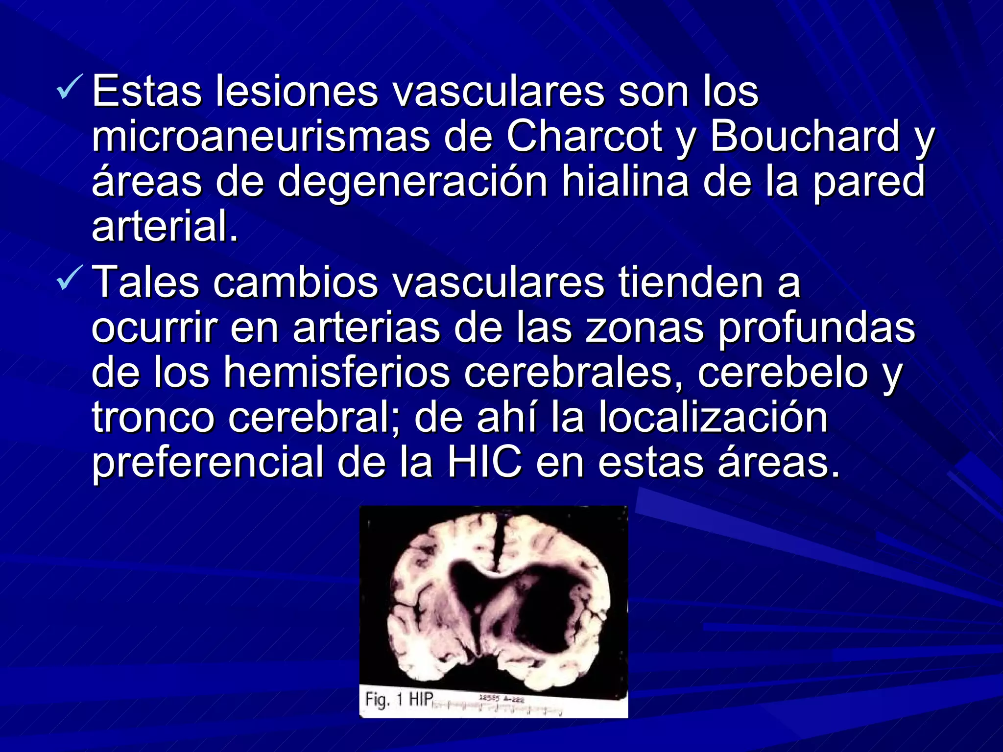 Evc Hemorragico | PPT