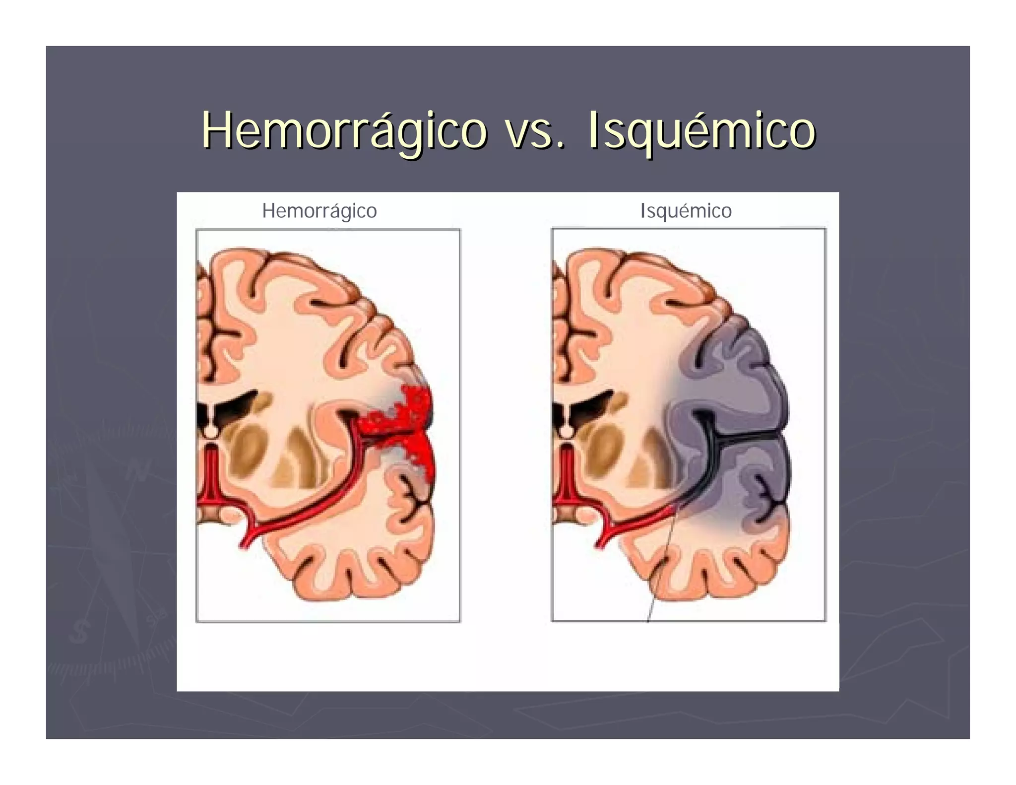 Evc Hemorragico | PPT