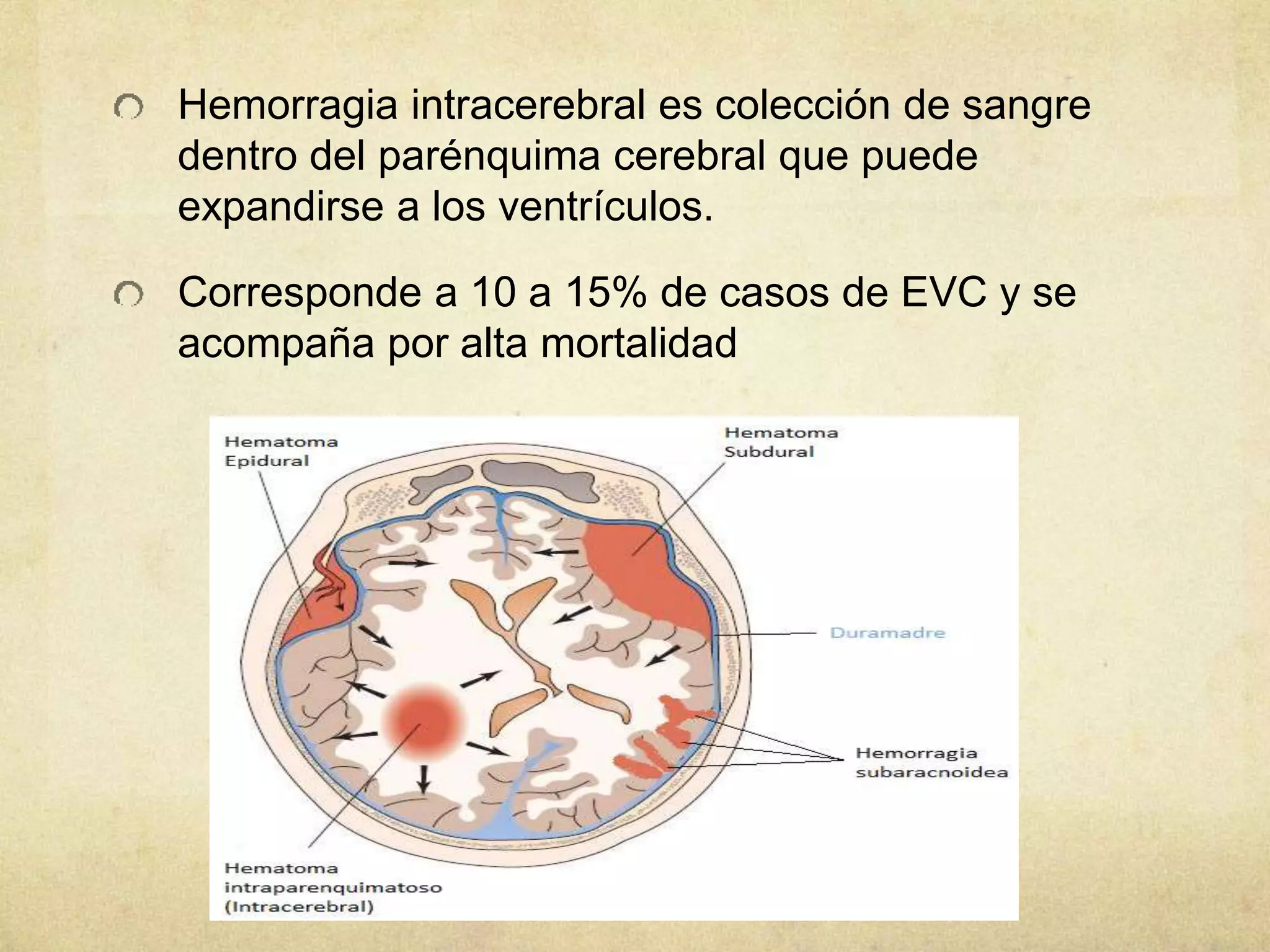 Evc hemorrágico | PPT