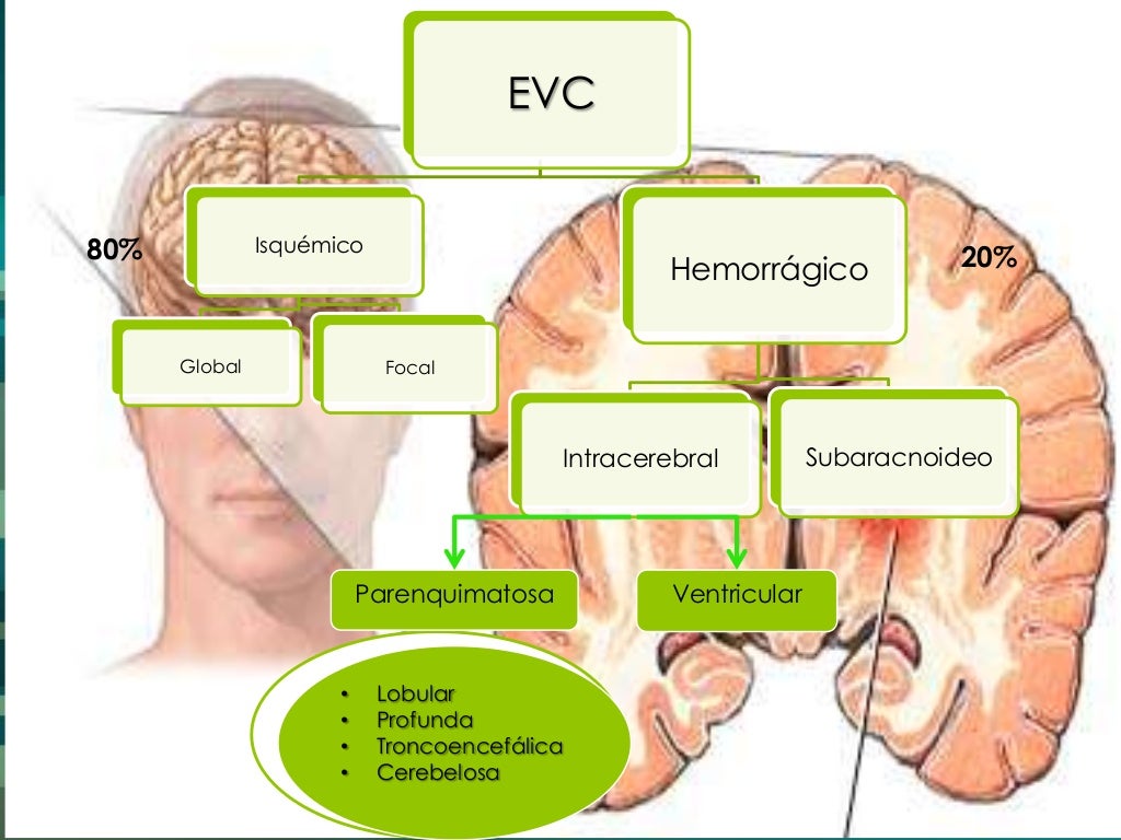 Evc Hemorrágico