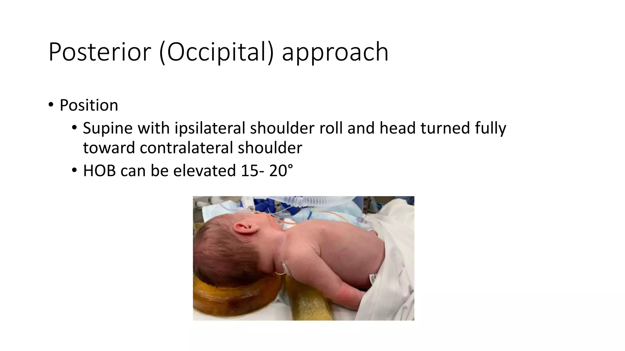 External Ventricular Drain (EVD) | PPTX