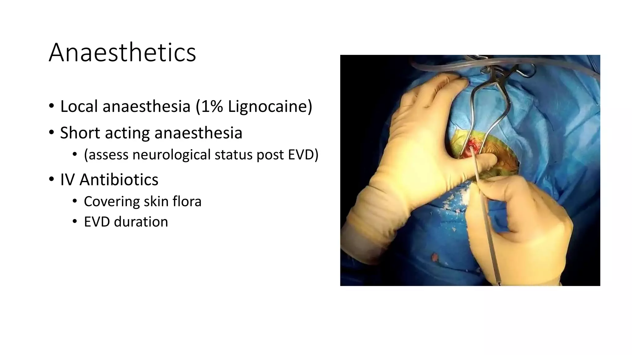 External Ventricular Drain (EVD) | PPTX