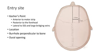External Ventricular Drain (EVD) | PPTX