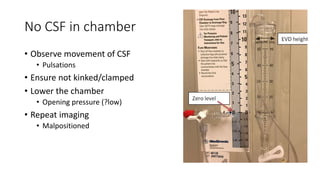 External Ventricular Drain (EVD) | PPTX