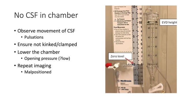 External Ventricular Drain (EVD) | PPTX