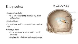 External Ventricular Drain (EVD) | PPT