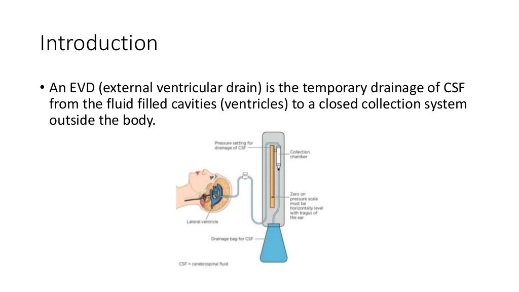 External Ventricular Drain (EVD)
