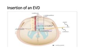 evd.pptx
