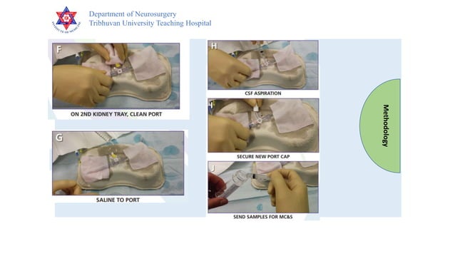 Evd bundle care plan | PPTX