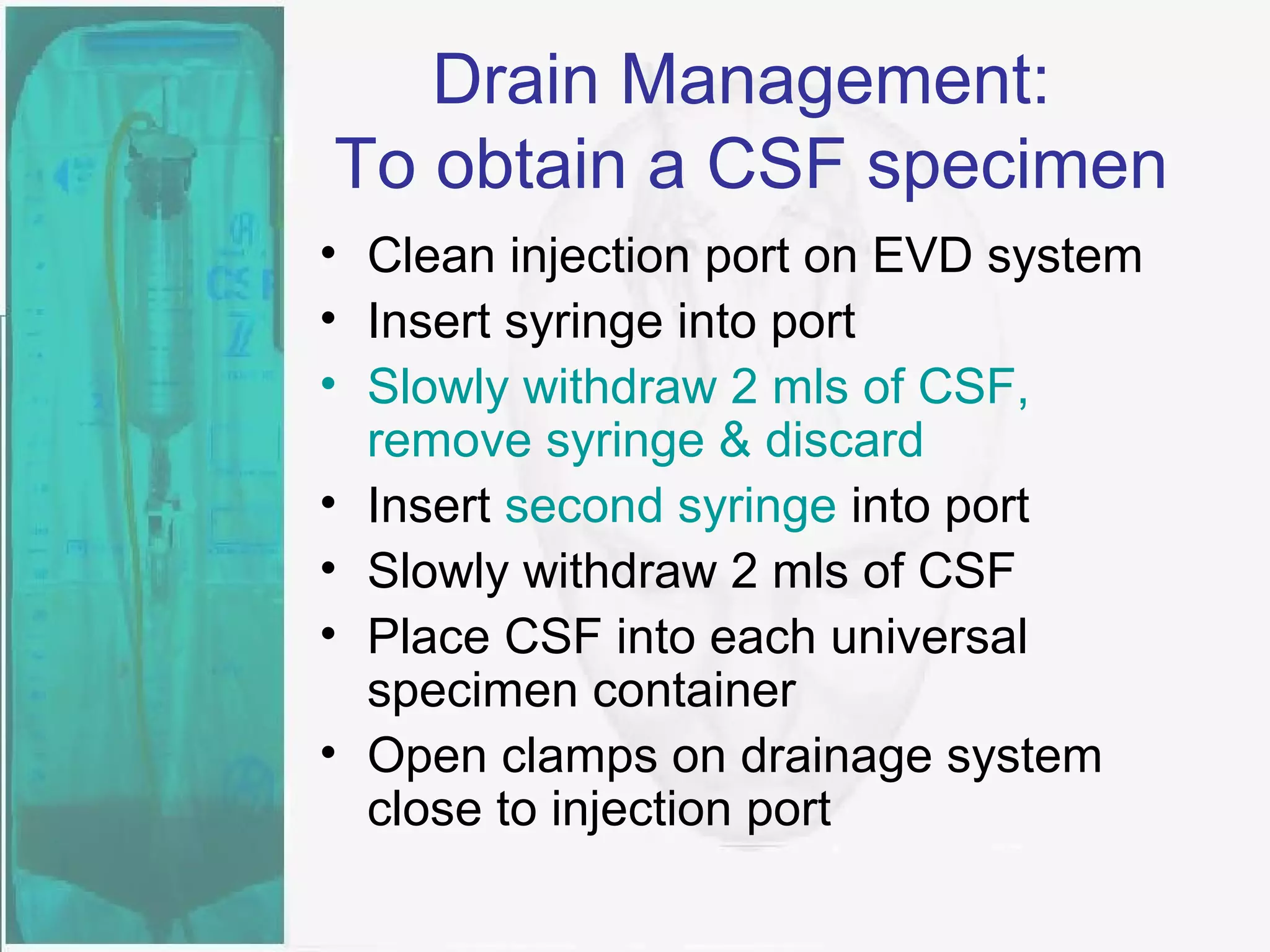 External Ventricular Drain | PPT