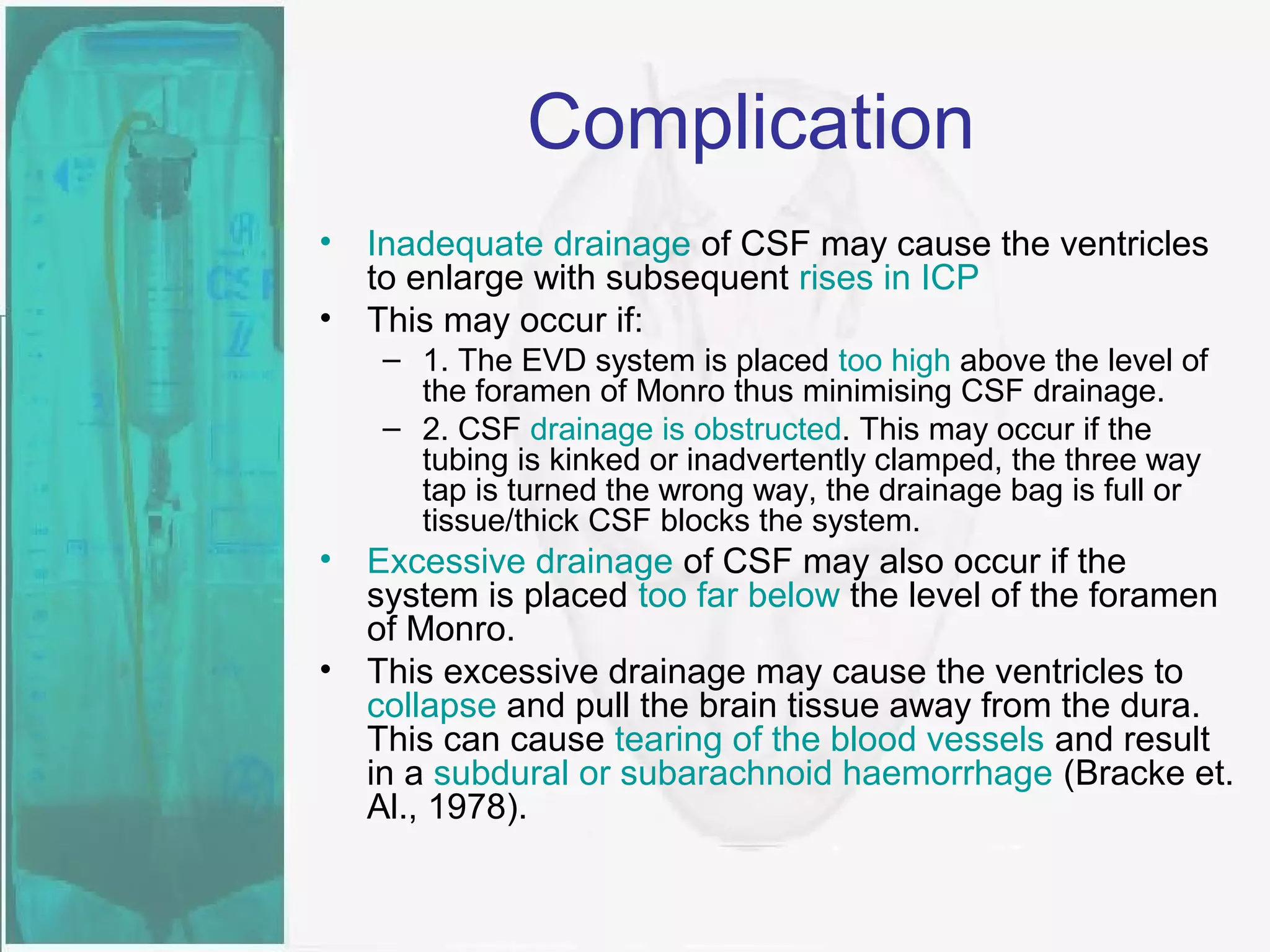 External Ventricular Drain | PPT