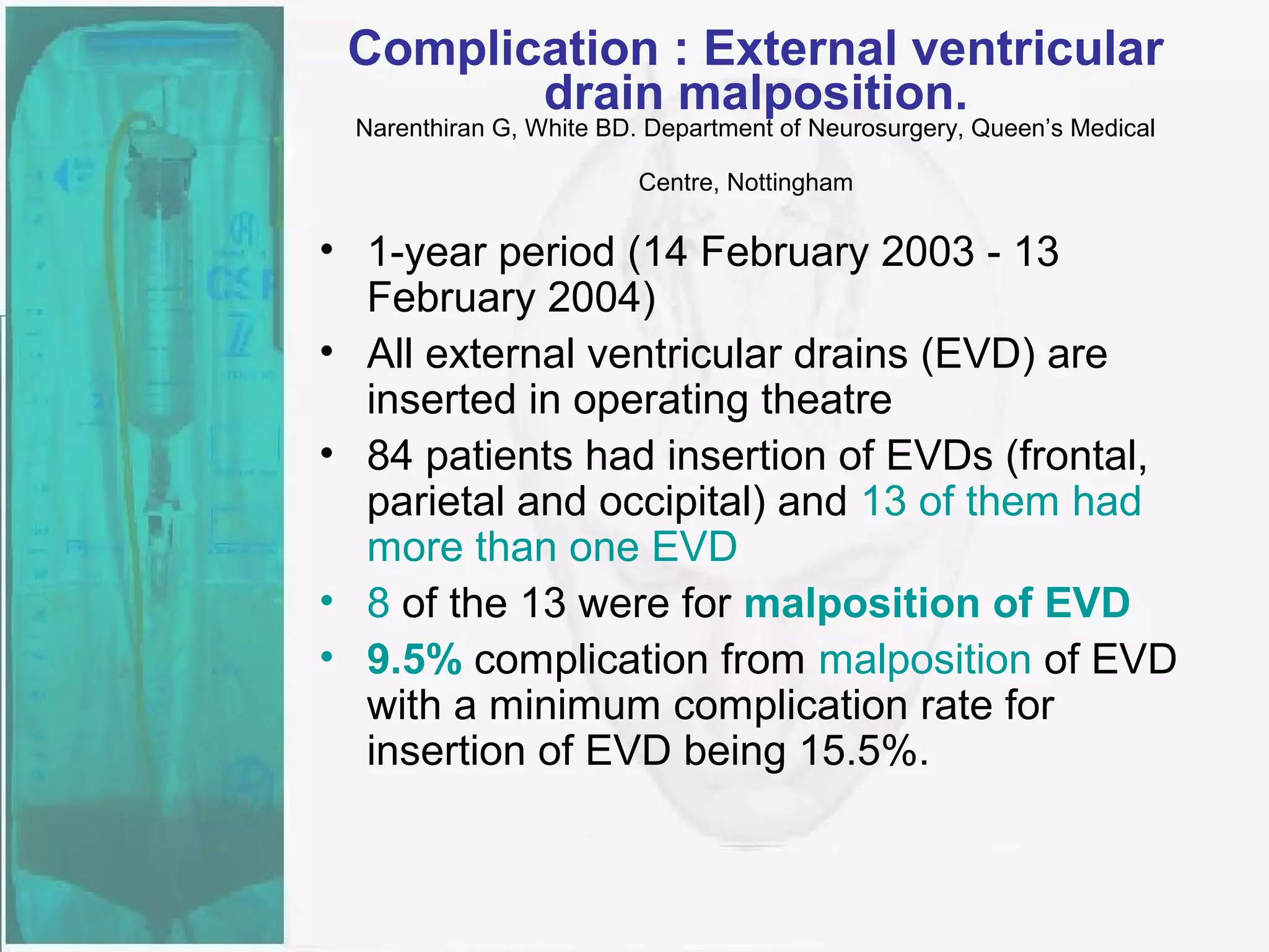 External Ventricular Drain | PPT