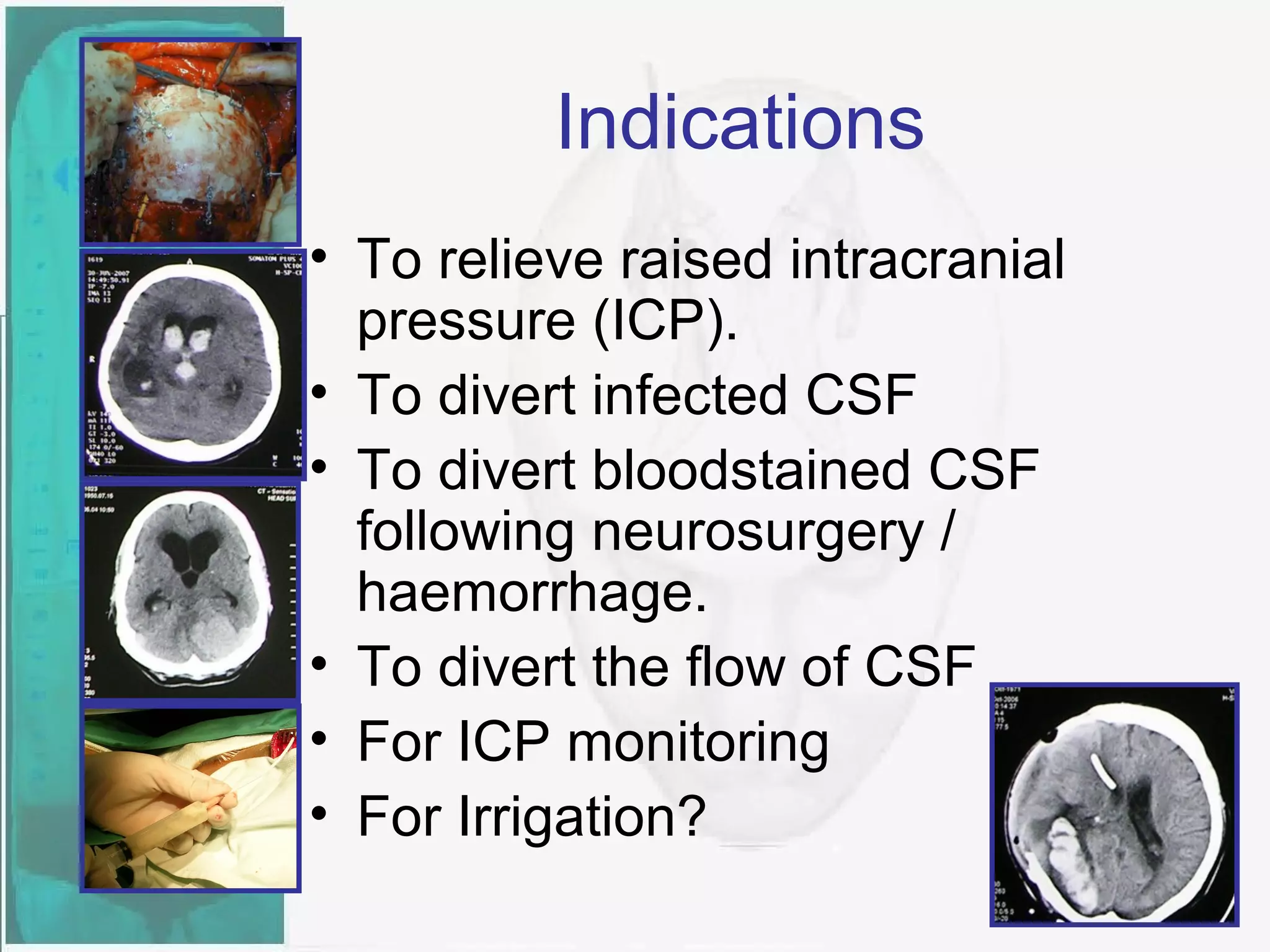 External Ventricular Drain | PPT