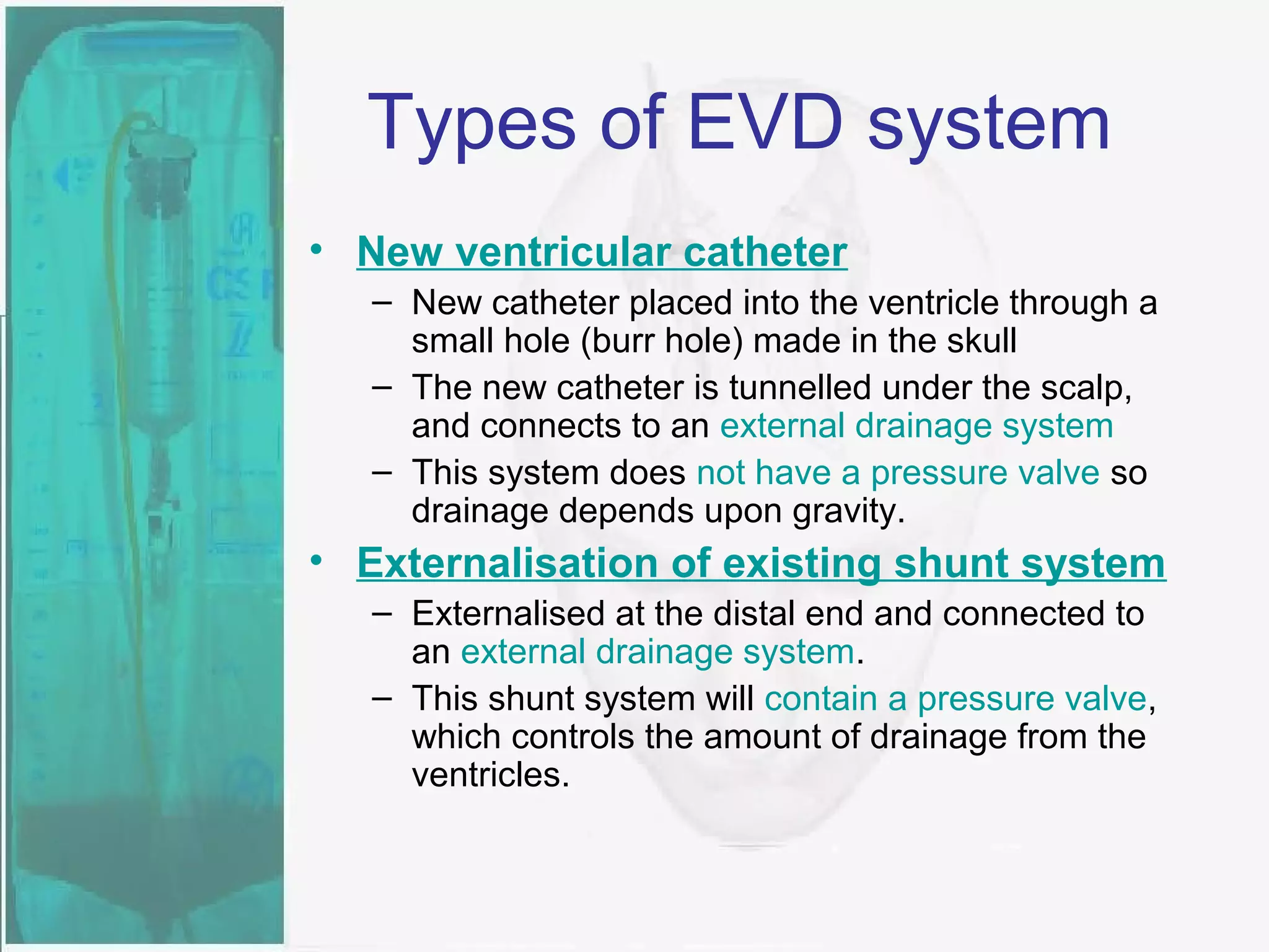 External Ventricular Drain | PPT