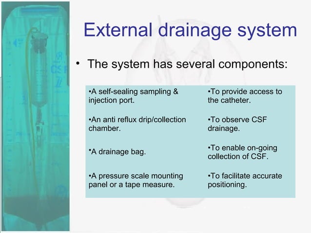 External Ventricular Drain | PPT