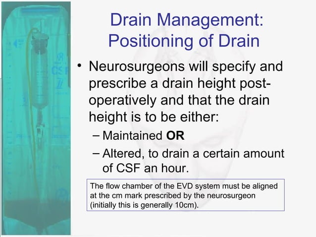 External Ventricular Drain | PPT
