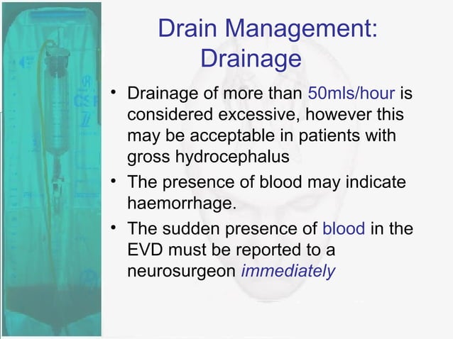 External Ventricular Drain | PPT