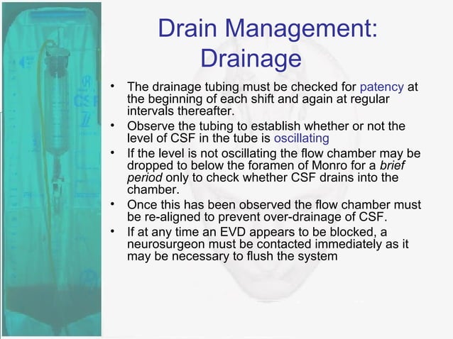 External Ventricular Drain | PPT