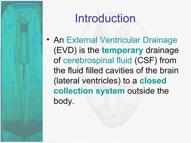 External Ventricular Drain | PPT